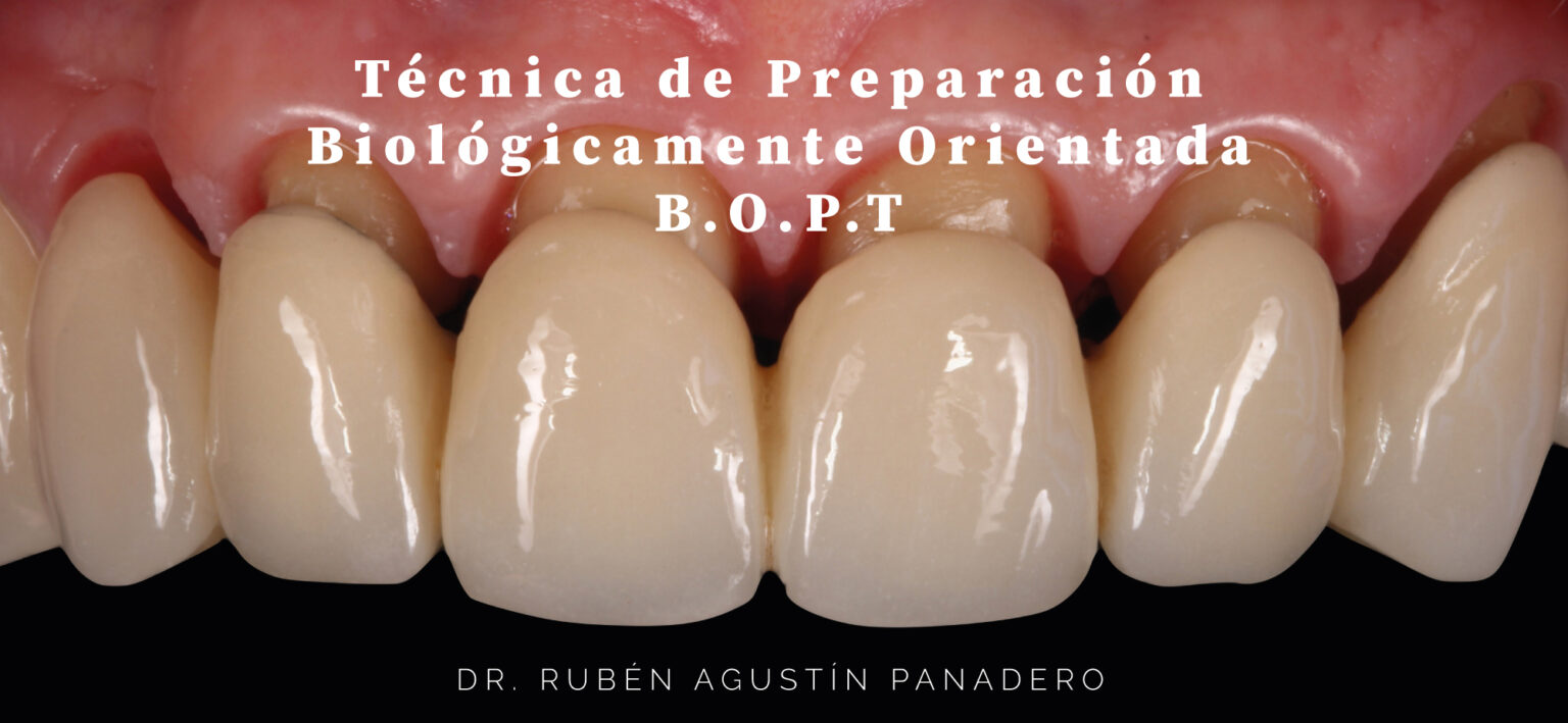 Técnica de Preparación Biológicamente Orientada B.O.P.T - Centro Forma